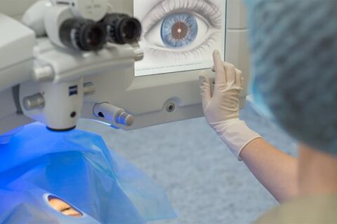 Opération de l'astigmatisme : déroulement de la chirurgie - Dr Ancel